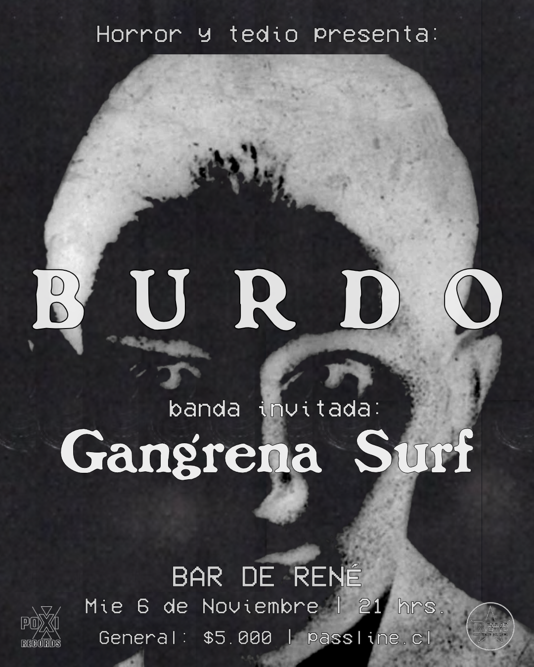 Rockaxis | Burdo y Gangrena Surf anuncian show en vivo en el Bar de René